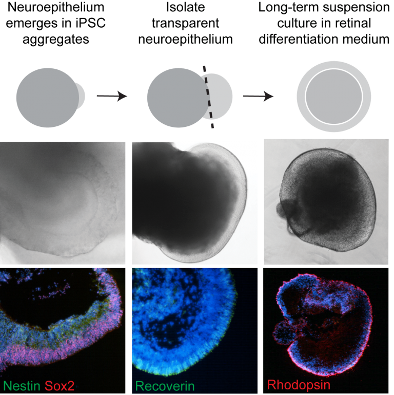 3D retinas made from patient stem cells shed light on mechanisms of ...