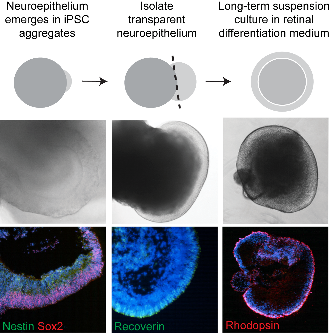 3D retinas made from patient stem cells shed light on mechanisms of ...