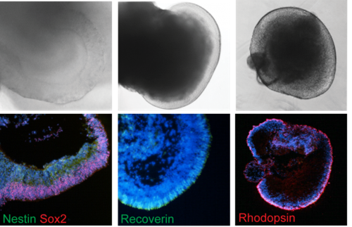 3D retinas made from patient stem cells shed light on mechanisms of ...