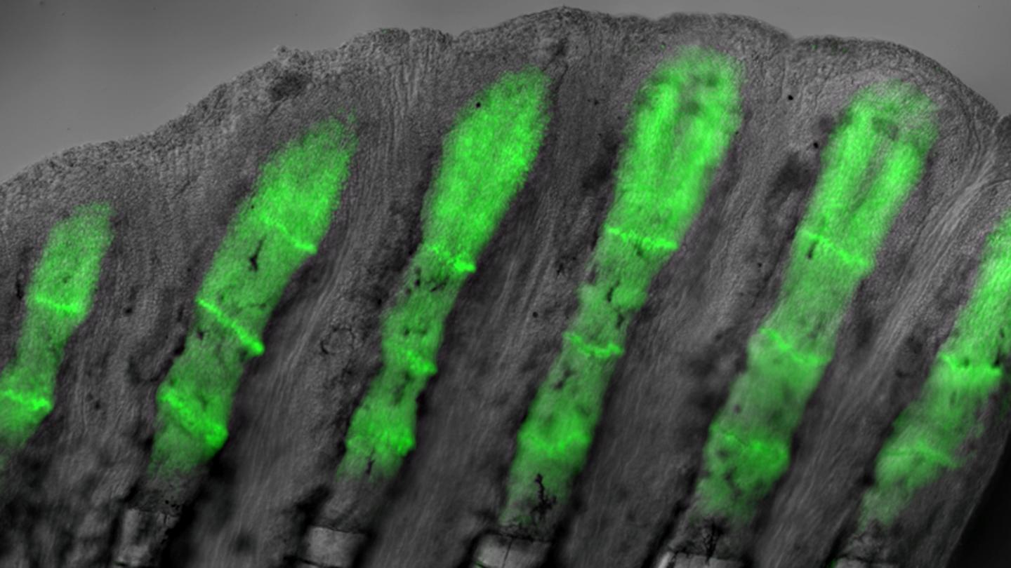 Biologists find 'skin-and-bones' mechanism underlying zebrafish fin ...