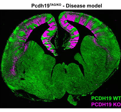 The Curious Case of Protocadherin 19 Epilepsy - the Node