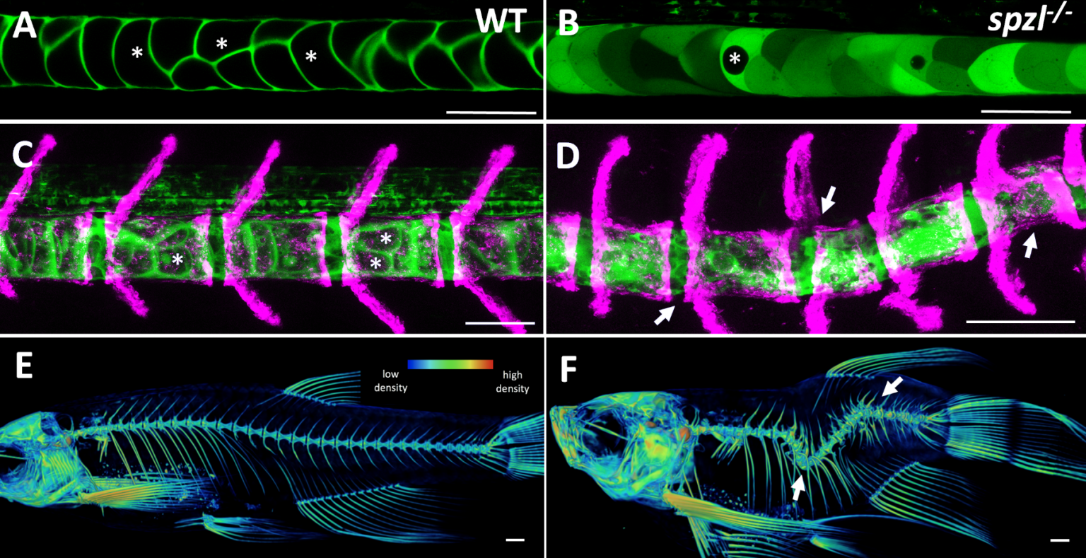 Kink in the road: the notochord’s role in spine formation and scoliosis ...
