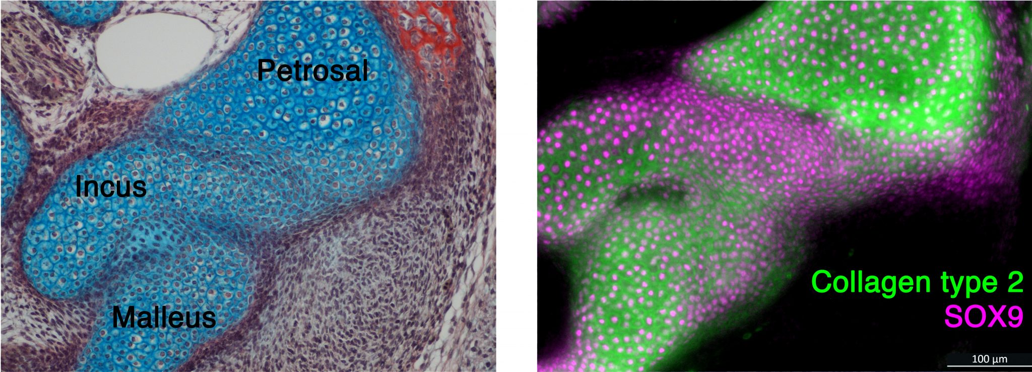 Monotreme ears and the evolution of mammal jaws - the Node