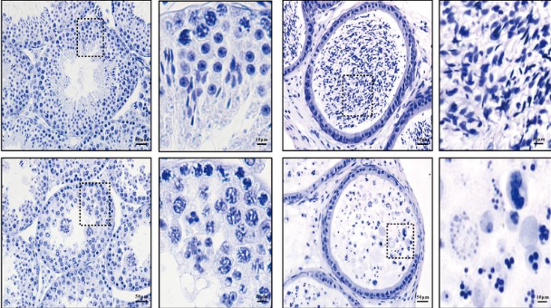 September in preprints - the Node
