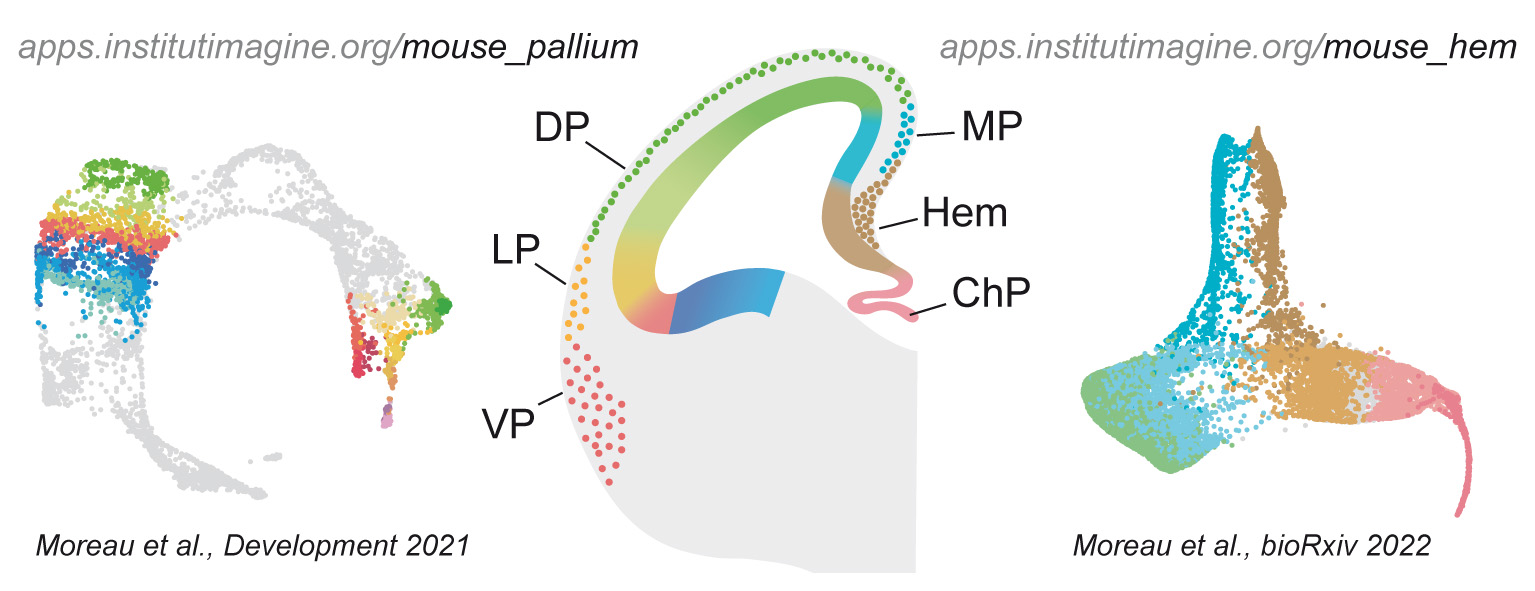 scRNAseq of the cortical hem and choroid plexus - the Node
