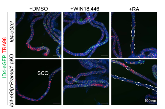 My journey to explore the mystery during spermatogenesis - the Node