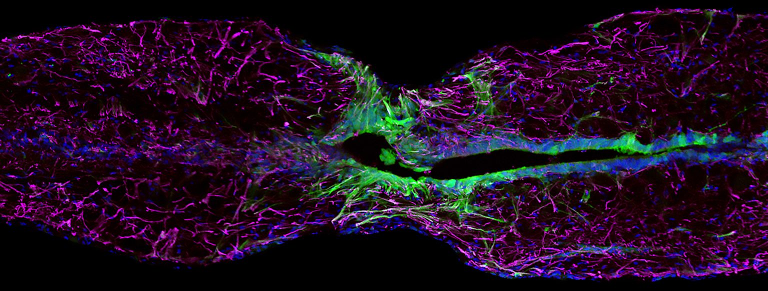 Postdoctoral Position in Spinal Cord Regeneration - the Node