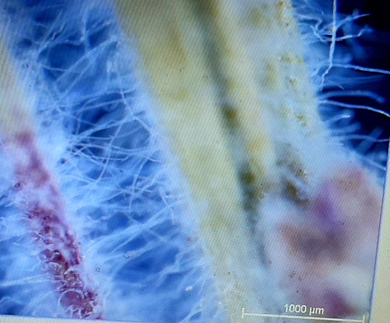 Unravelling plant surface appendages - the Node