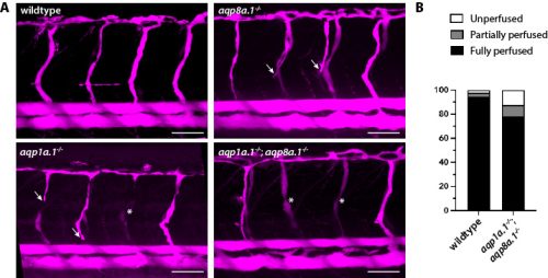 Exploring the Uncharted Waters of Endothelial Tip Cell Migration: A ...
