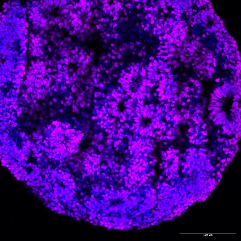 Hybrid brains and the search for what makes us human - the Node