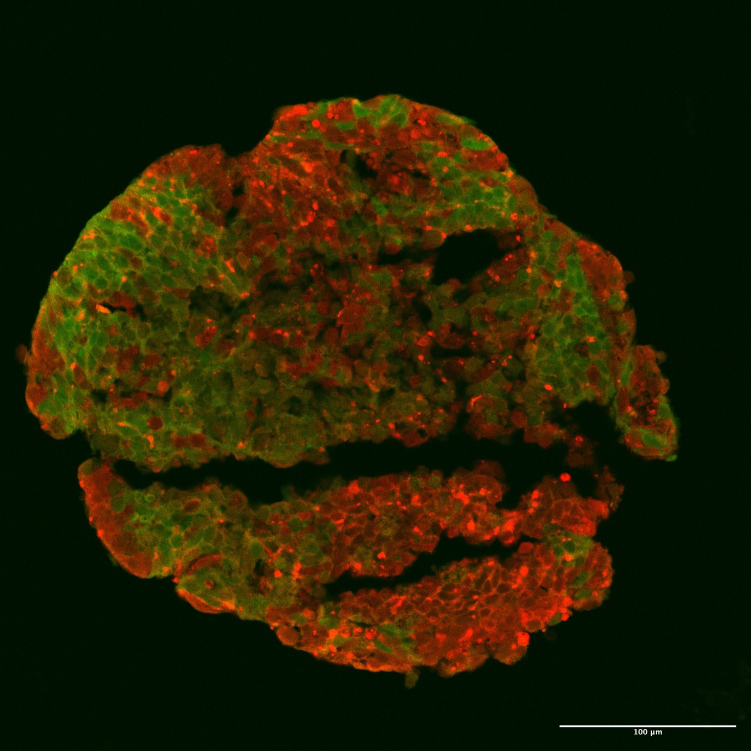 Hybrid brains and the search for what makes us human - the Node