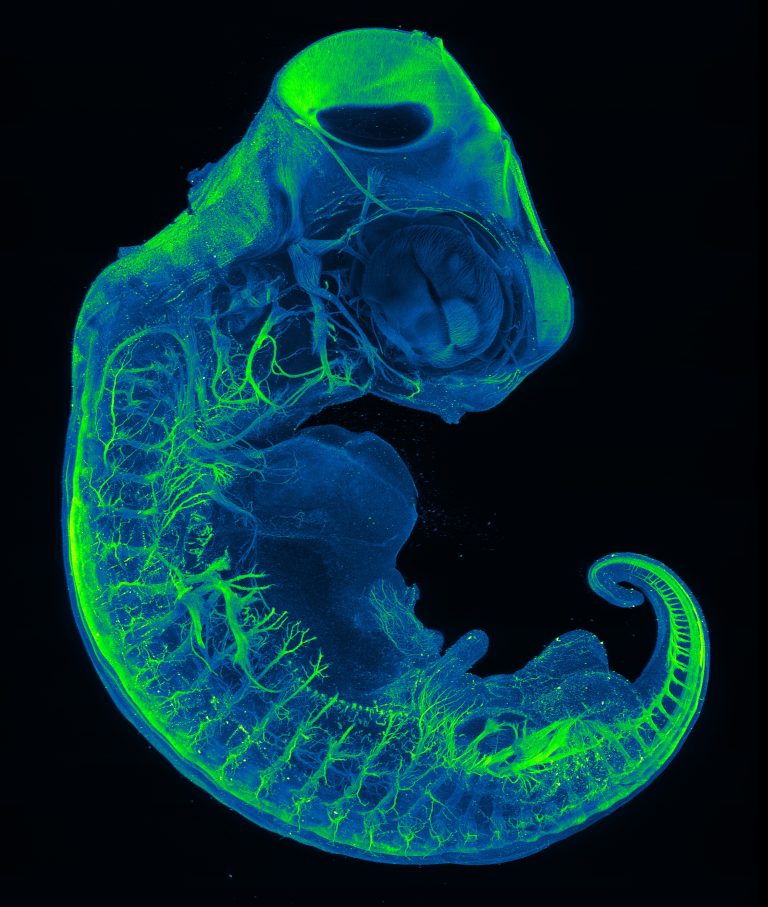 Vote for your favourite image from the MBL Embryology course - the Node